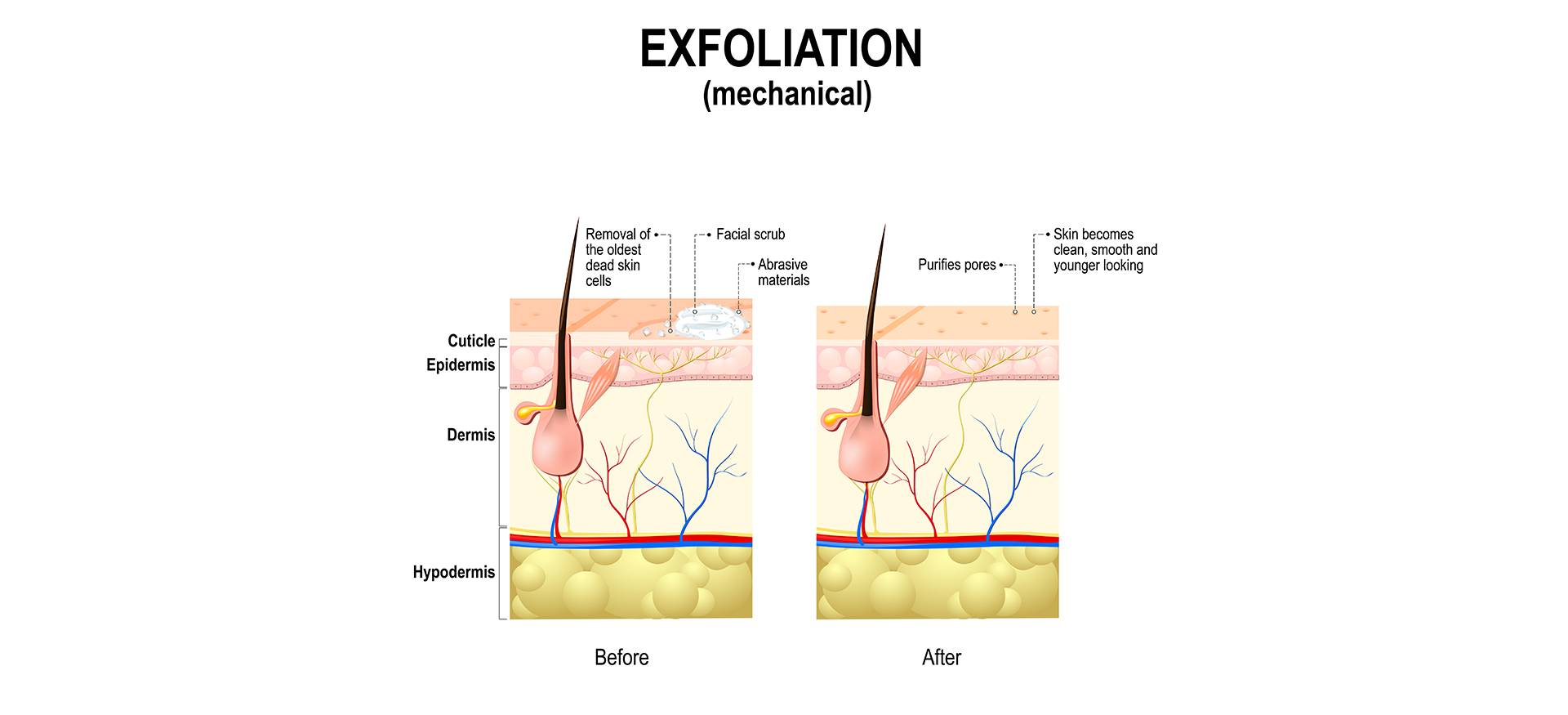 A Comprehensive Guide to Understanding Exfoliation- Everyuth Blog